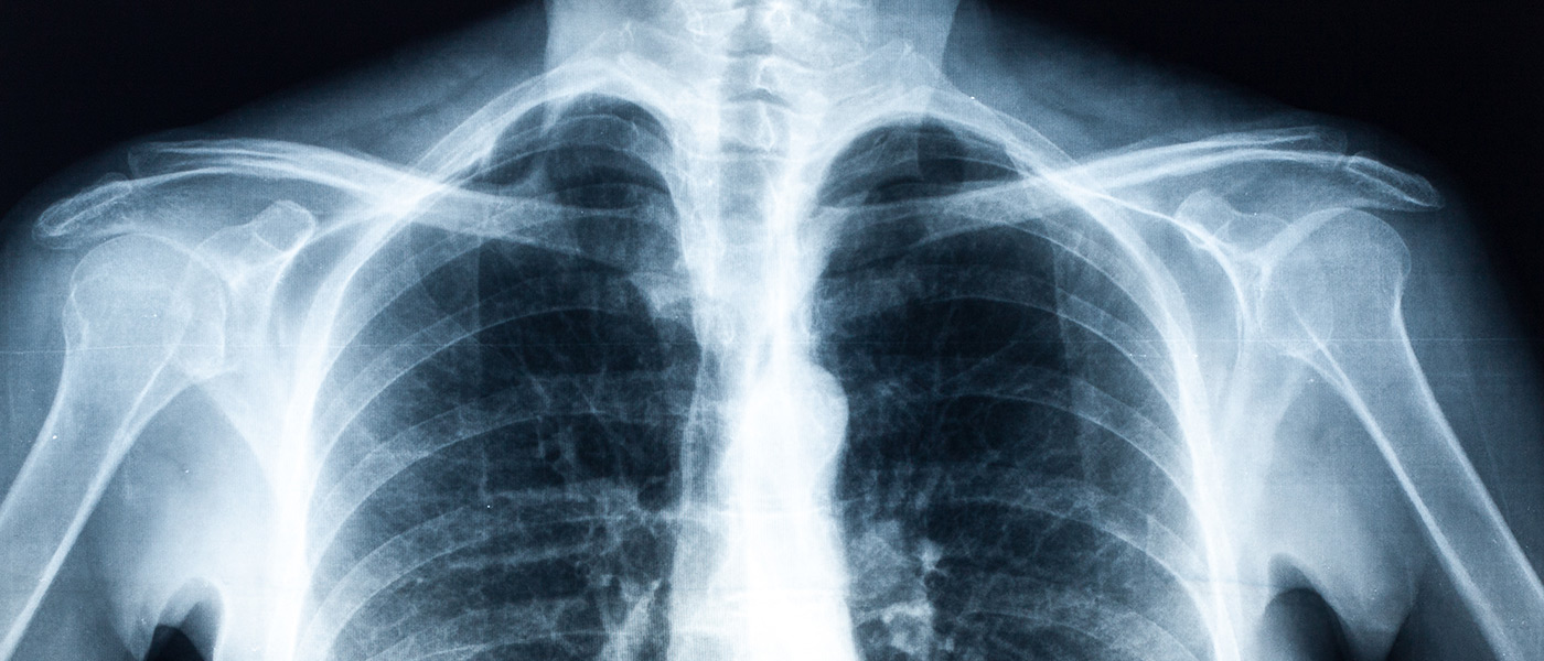 How To Xray Photos Xray Photos Check Spelling Or Type A New Query